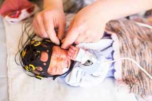 Neurological monitoring of the high-risk infant: EEG and aEEG - ESCNH - European Standards of ...