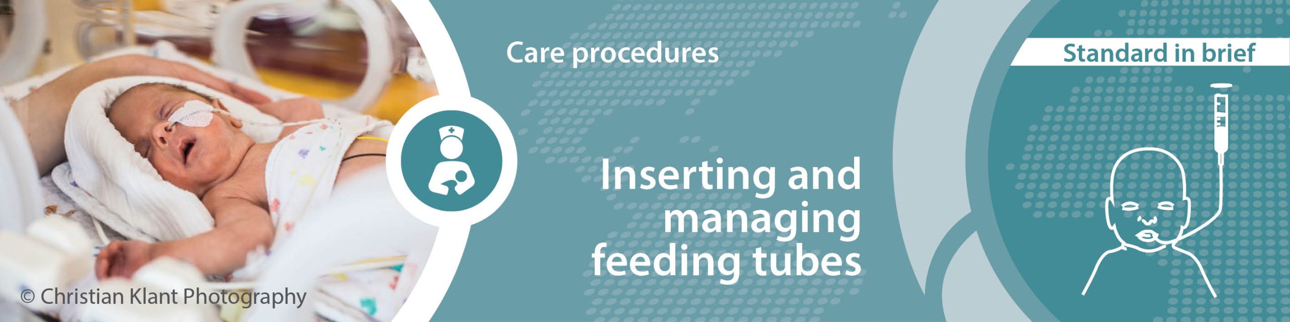 Inserting and managing feeding tubes - ESCNH - European Standards of ...